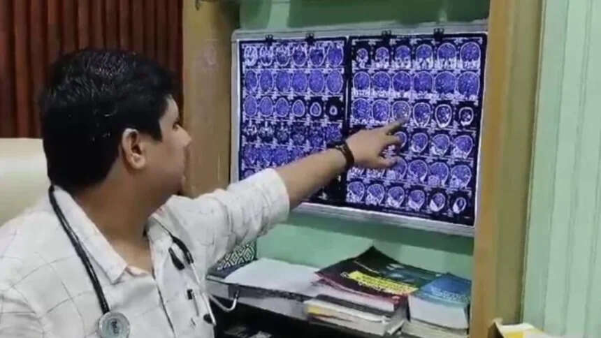 Sambhal Girl Suffers from Severe Headaches, CT Scan Reveals Shocking ...